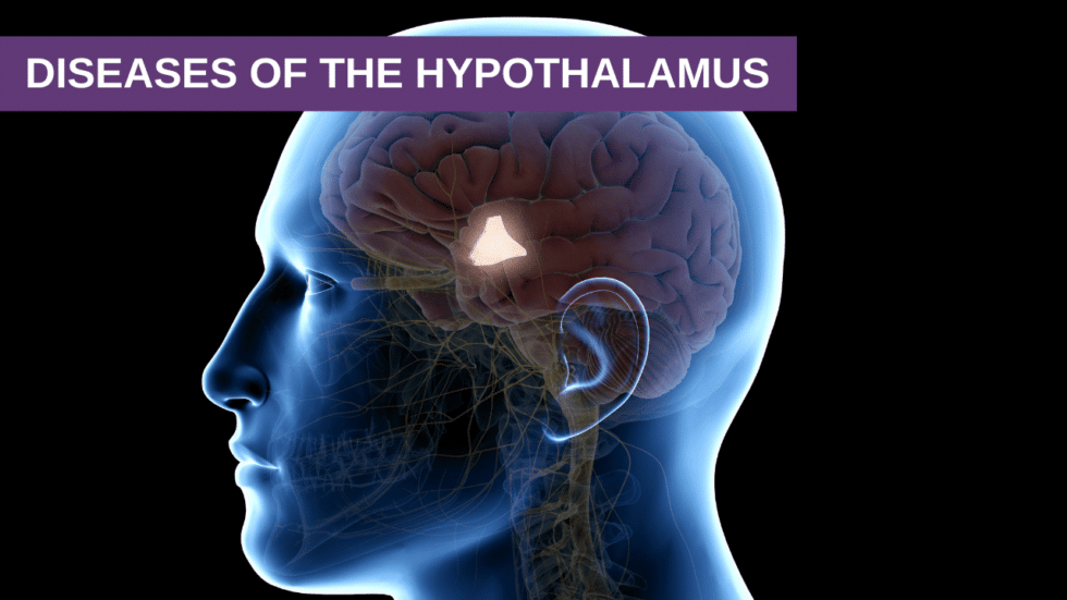 Diseases of the Hypothalamus - Genesis Gold - Hypothalamus