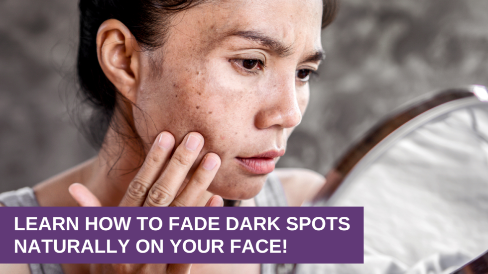 Learn How To Fade Dark Spots Naturally on Your Face! - Genesis Gold